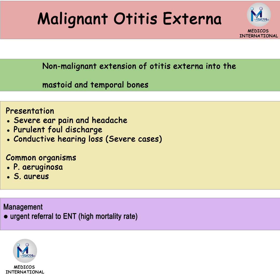 Malignant Otitis Externa