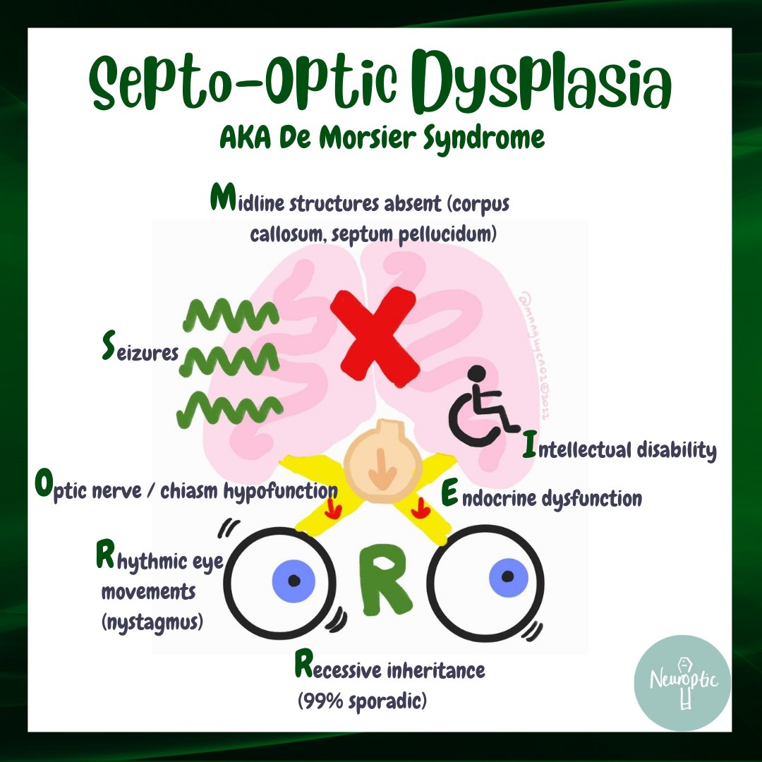 Septo Optic Dysplasia