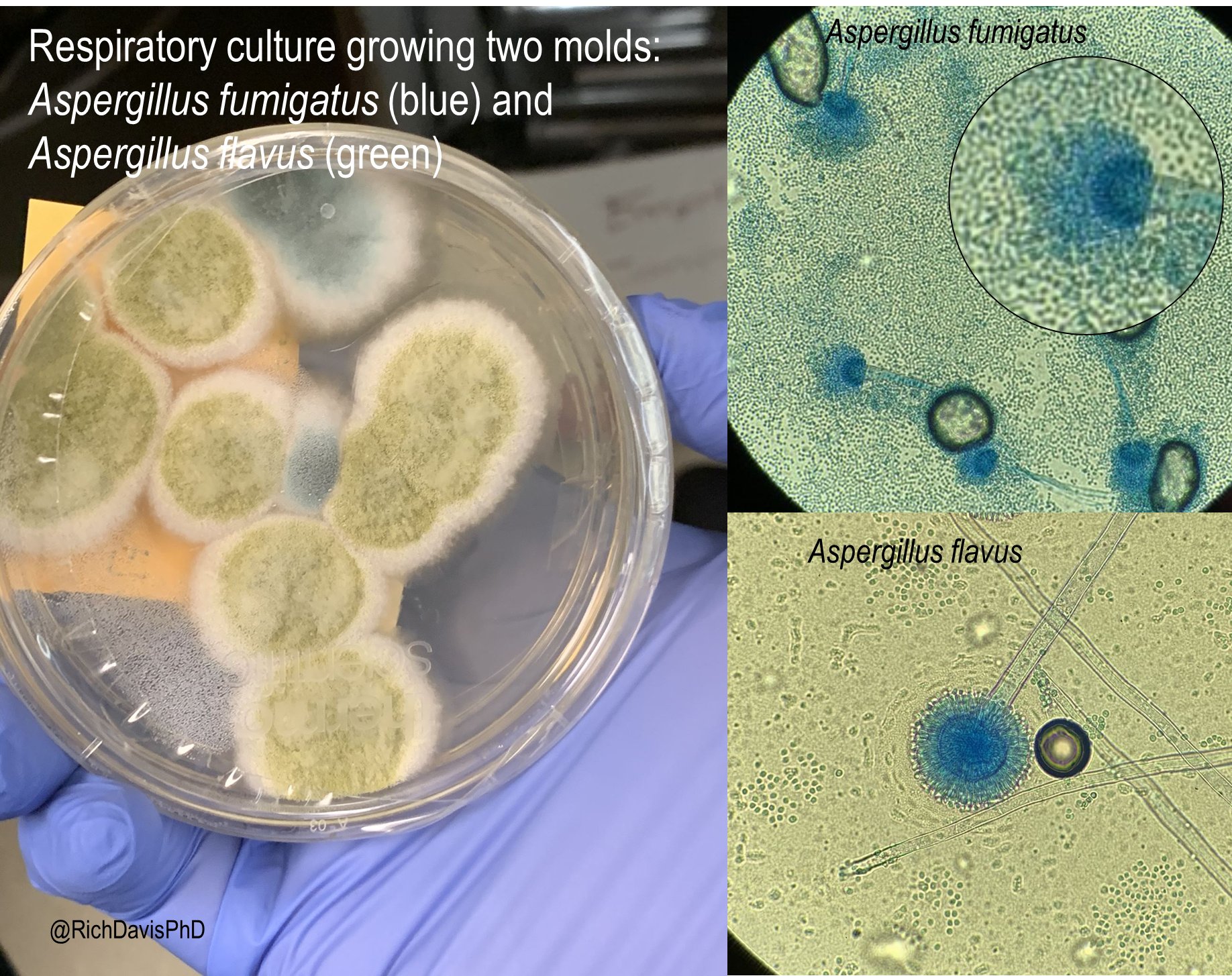 Aspergillus Flavus Morphology