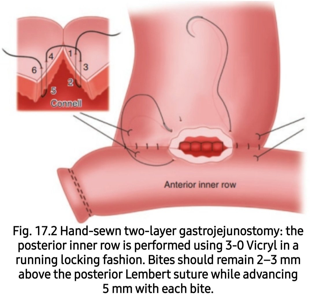Running Locking Stitch