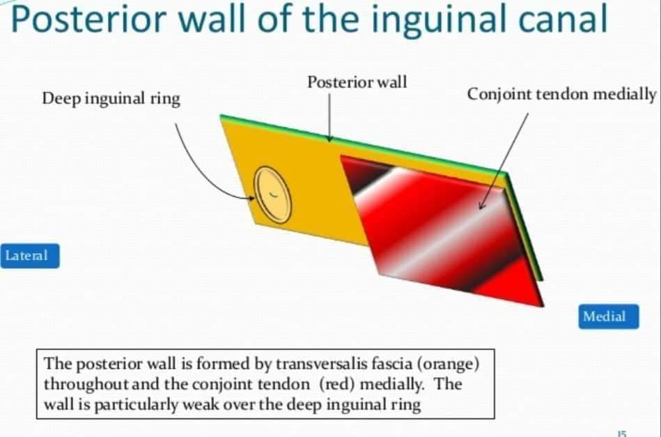 Conjoint Tendon Inguinal Canal