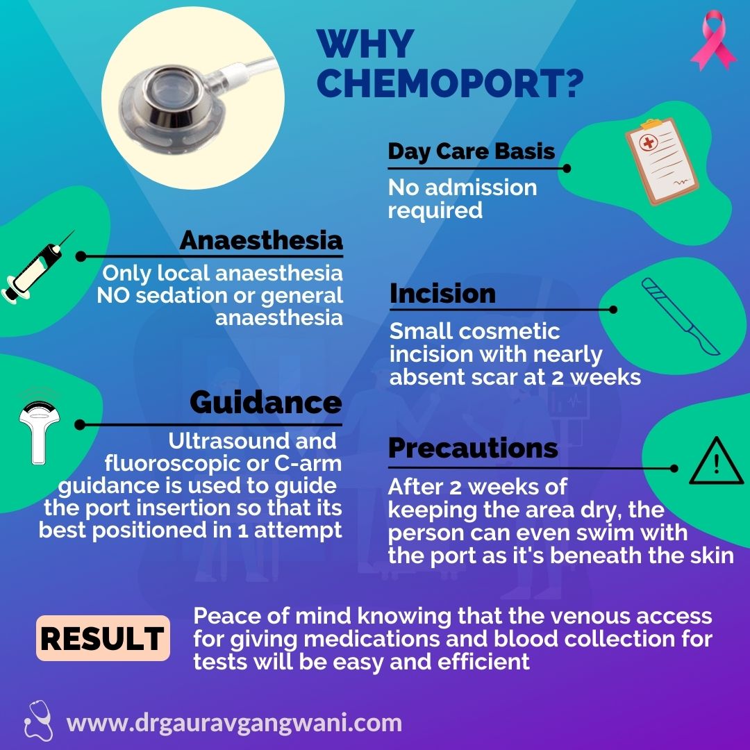 Chemo Port Procedure