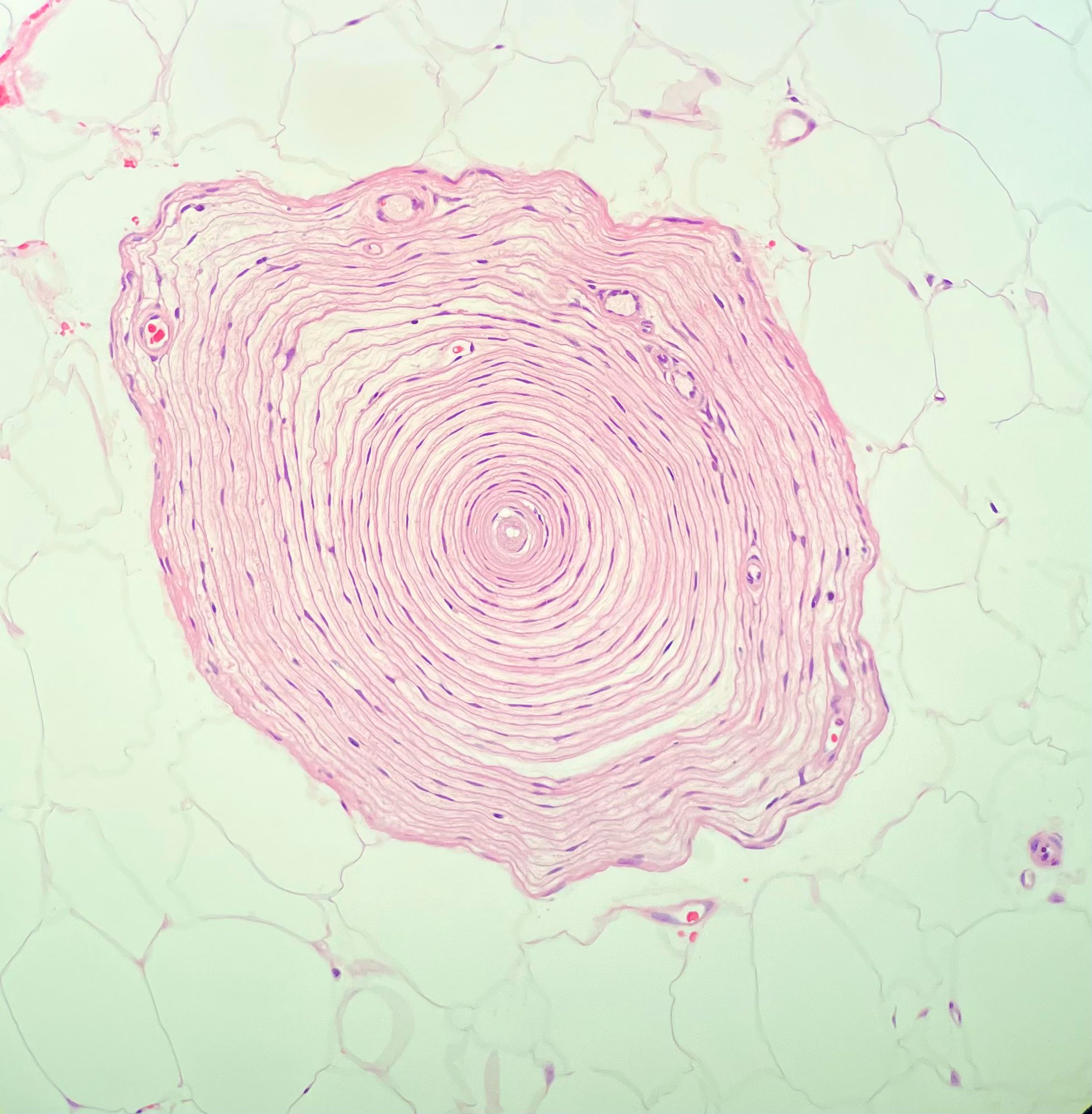 Pacinian Corpuscle Labeled
