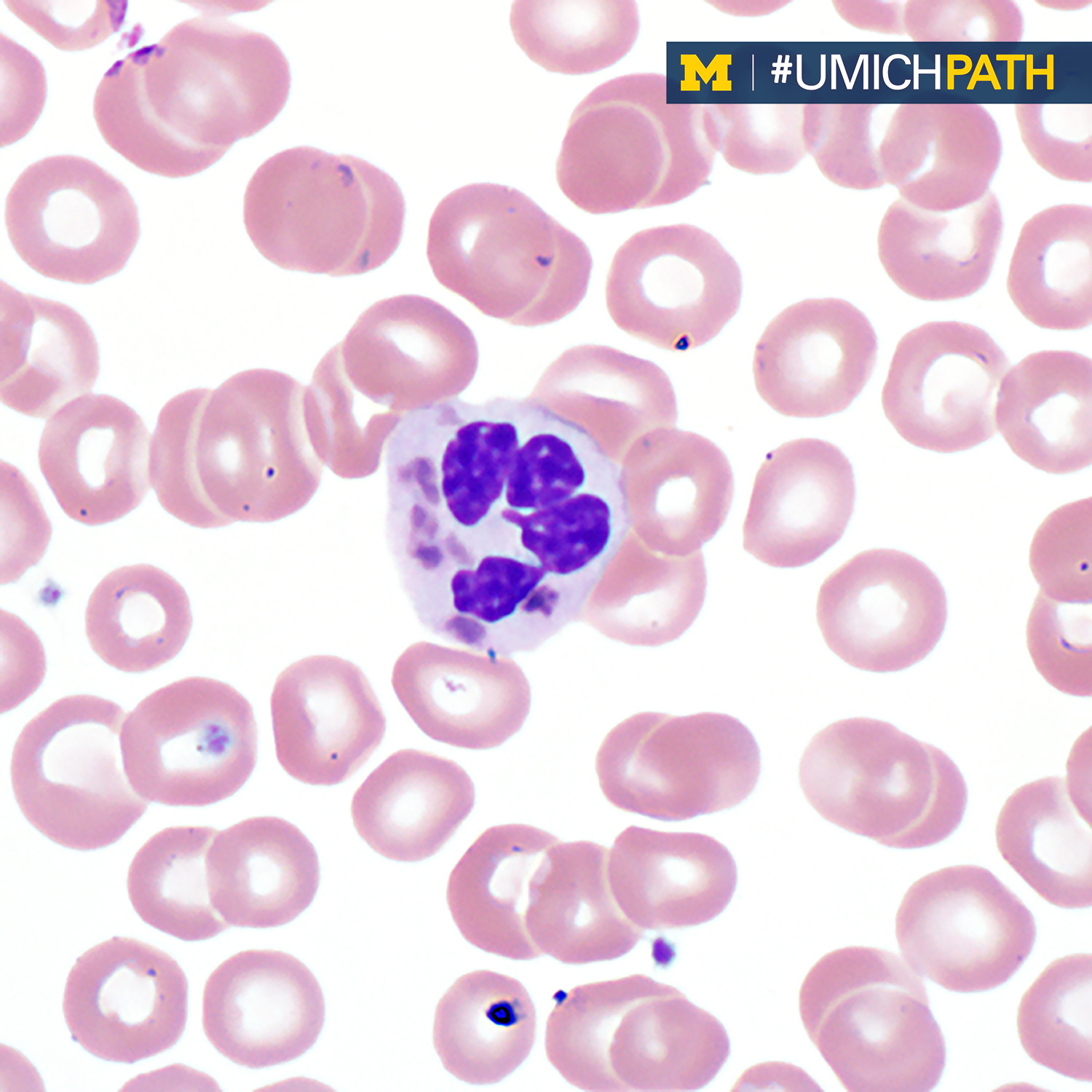 Peripheral Blood Differential
