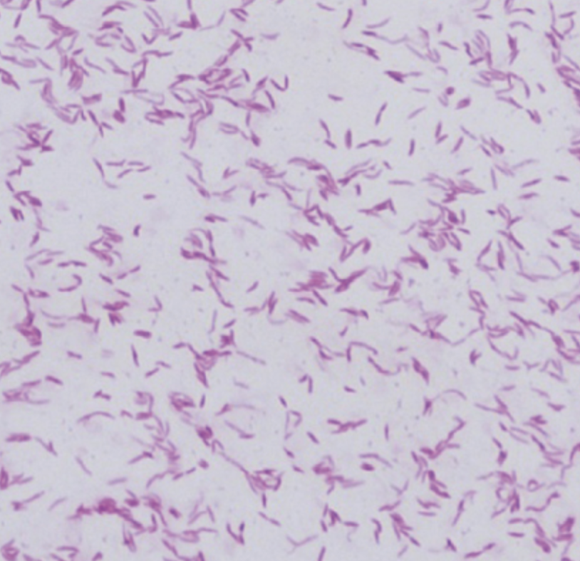 Mycobacterium Smegmatis Gram Stain