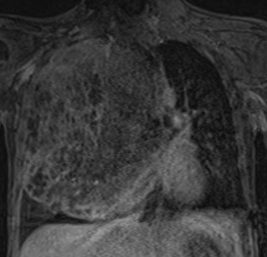 New Case! 🧵🧵 F7 paroxysmal nocturnal cough associated with wheezing ...