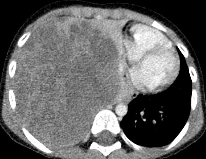 New Case! 🧵🧵 F7 paroxysmal nocturnal cough associated with wheezing ...