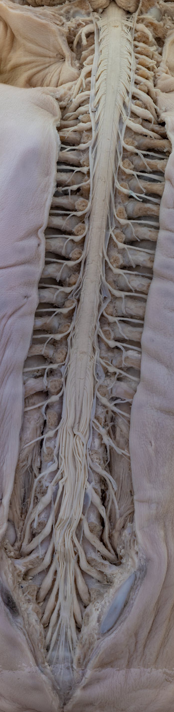 Cadaver Spinal Cord
