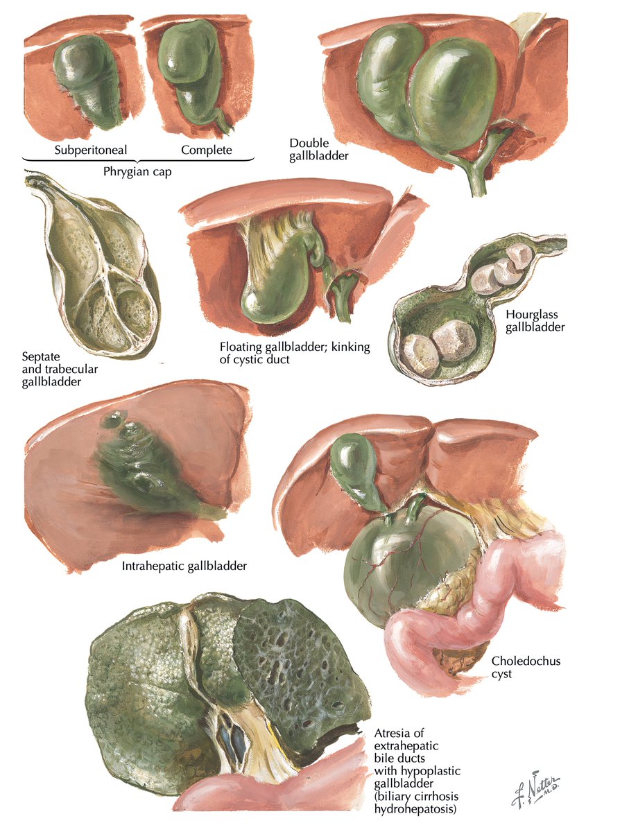 Gallbladder Anatomy Netter