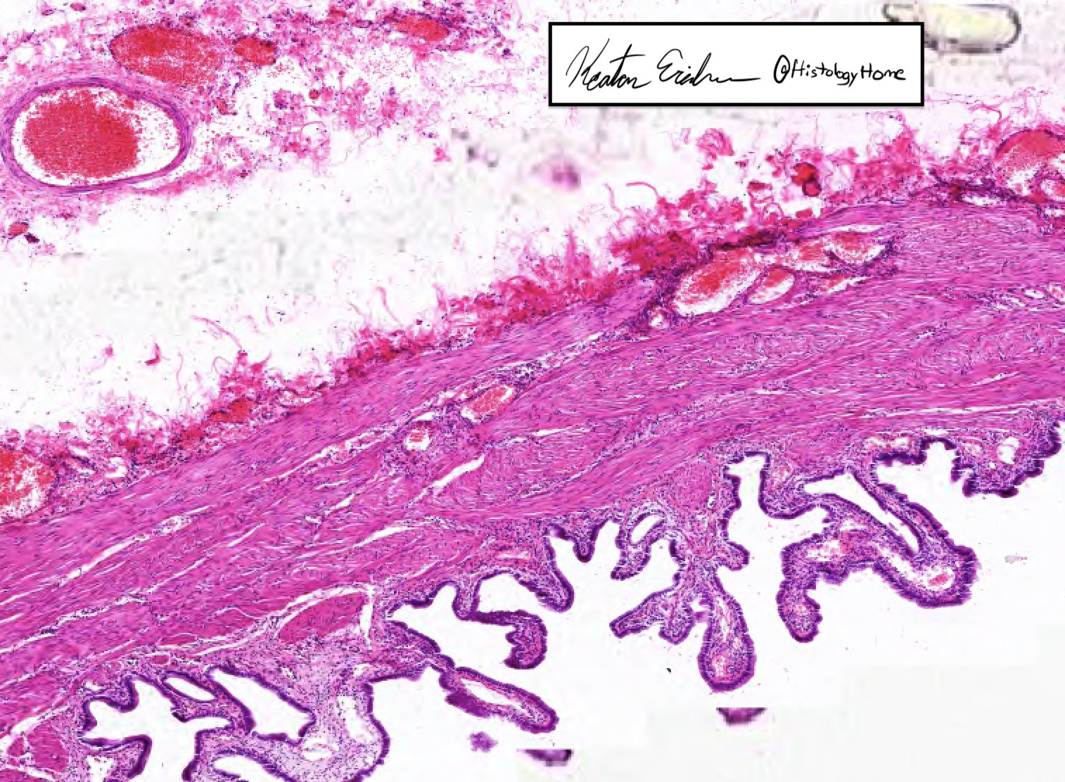 Gallbladder Labeled Histology