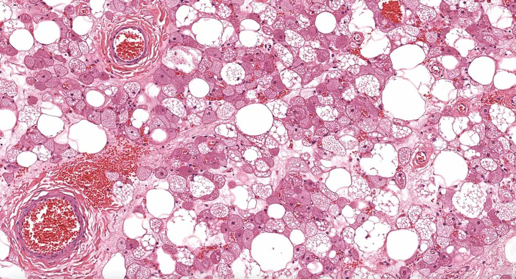 Subcutaneous Tissue Slide