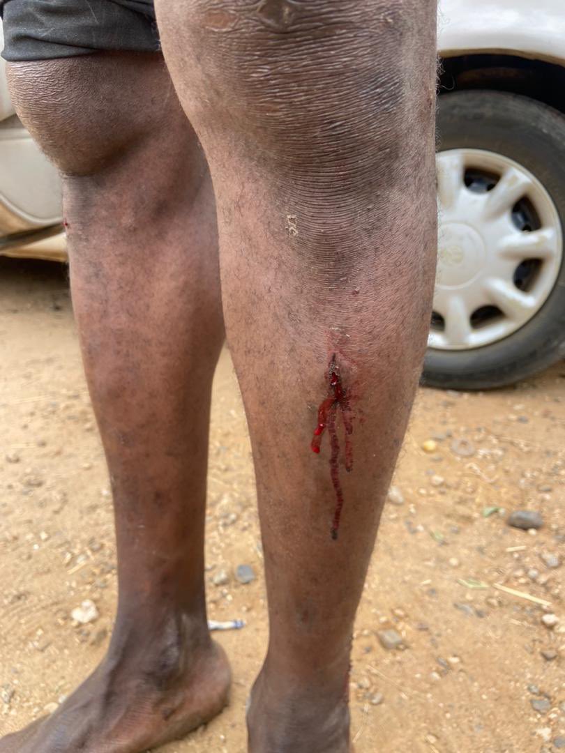 Patson Kanengoni (@KanengoniPatson) | Twitter