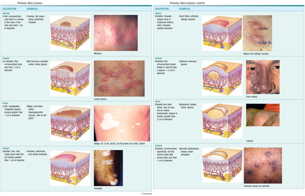 Skin Lesions Chart