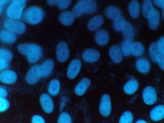 Mycoplasma Cell Culture Dapi