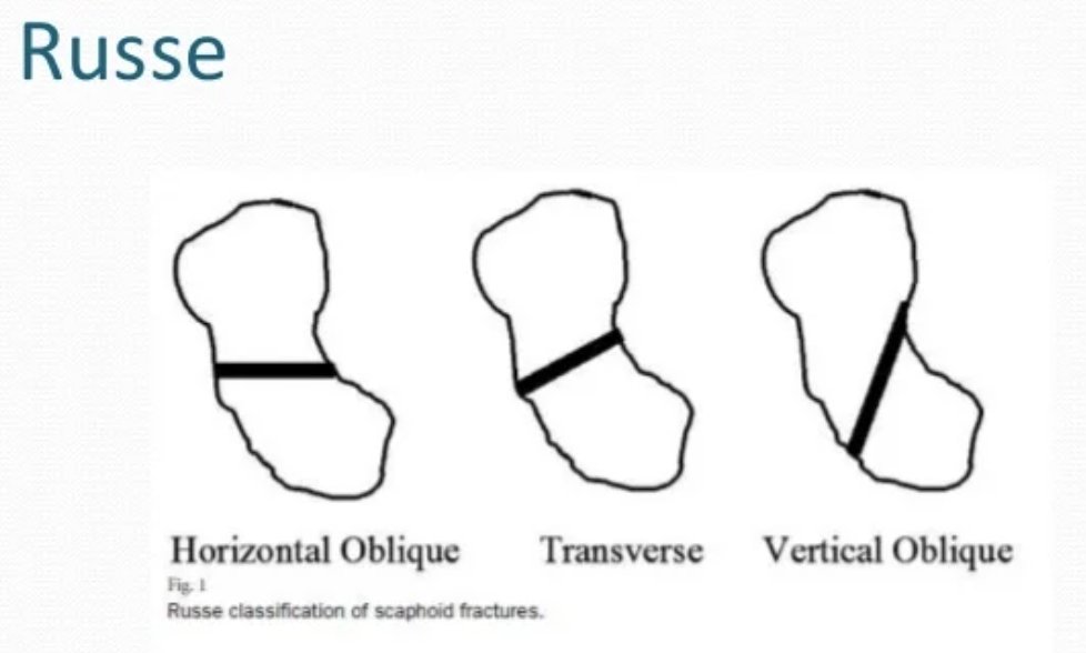 Scaphoid Fracture Classification