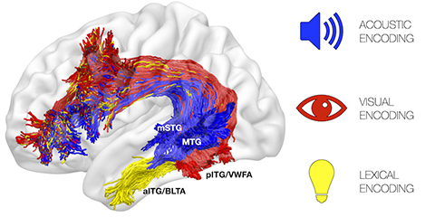Arcuate Fasciculus