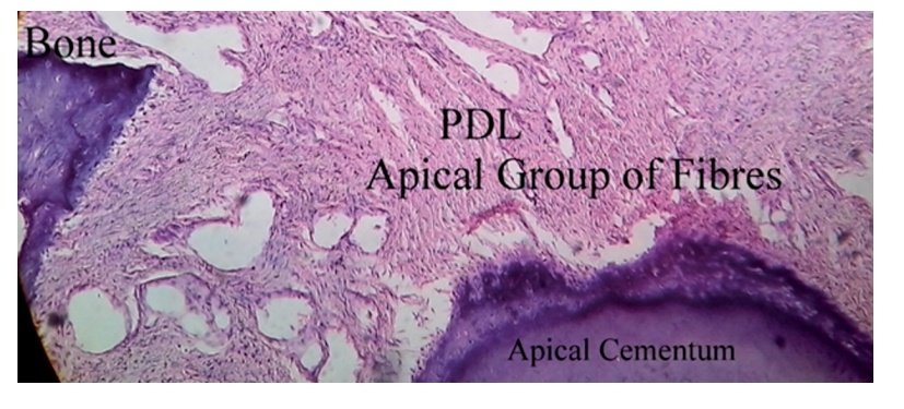 THE PRINCIPAL FIBERS OF THE PDL #Dental_by_Hadeel - Thread from هديل 🕊 ...