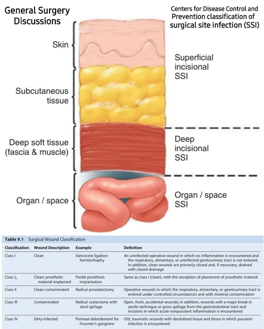 Surgical Site Wound Classification