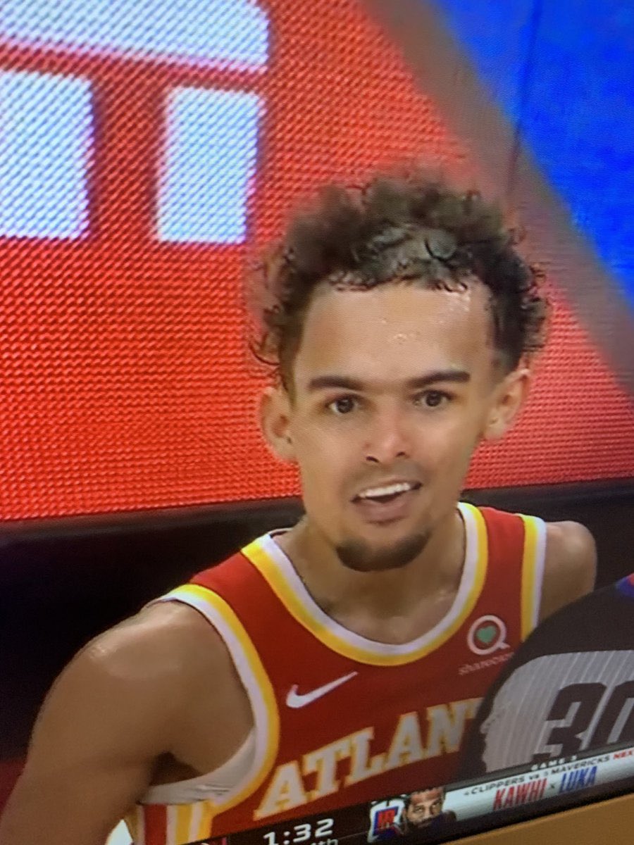 Worst Hairlines In Sports