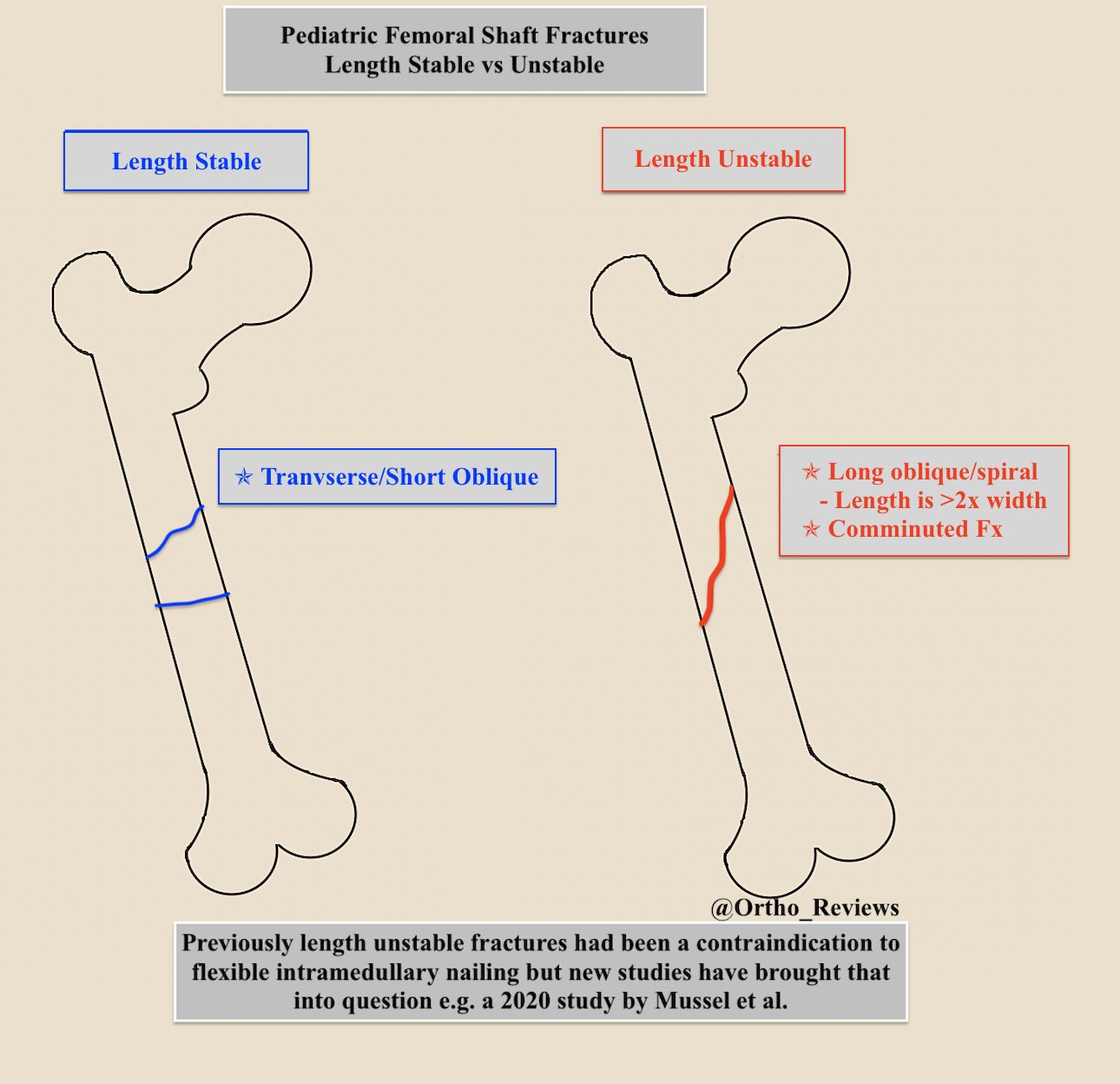 Comminuted Fractures