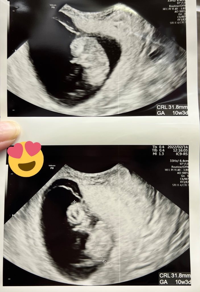 もっちぃ🤱👶11w3d (@kitchendrum) | Twitter