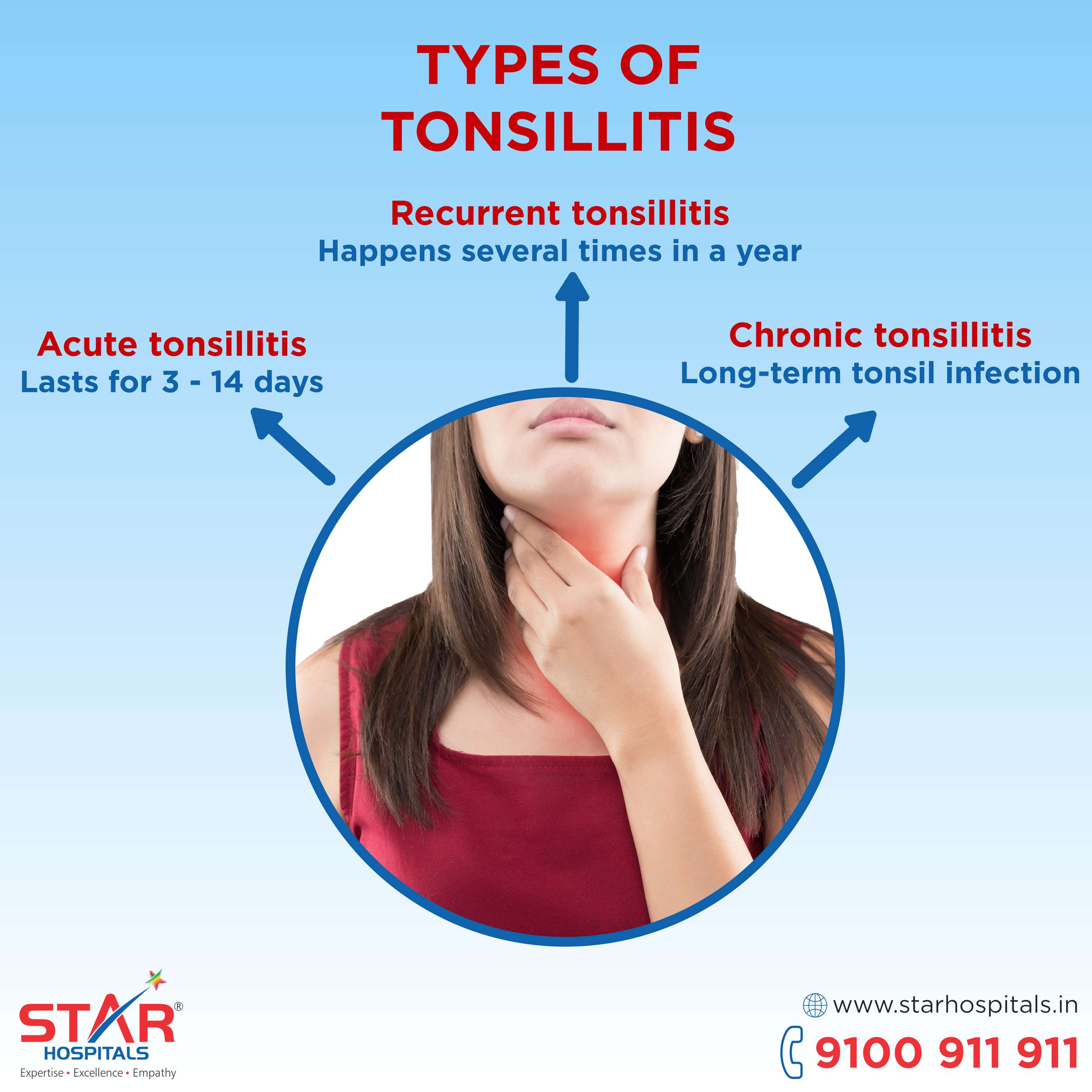 Acute Tonsillitis