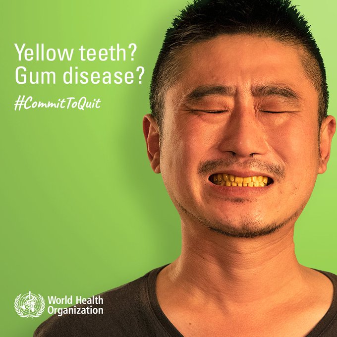 Yellowest Teeth In The World