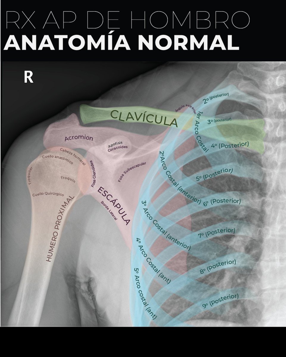 Hombro Normal De Rayos X