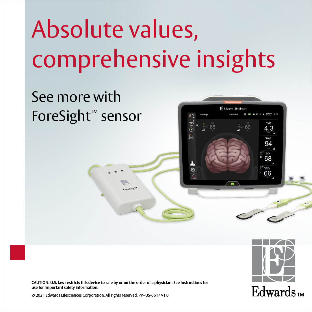 Nest es ist wunderschön Kloster edwards monitor Ablehnen Kontinuierlich ...