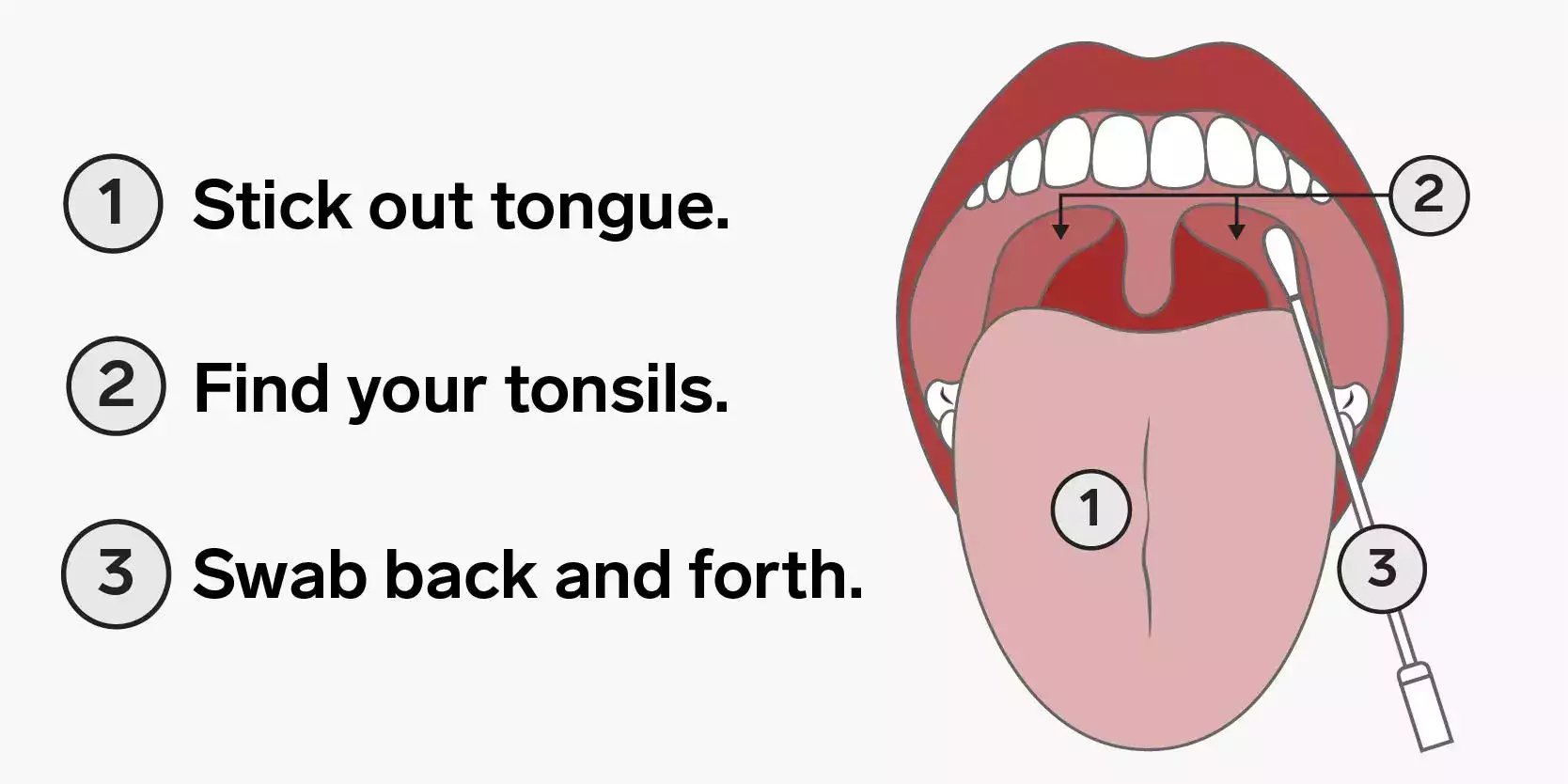 Streptococcus Pyogenes Throat