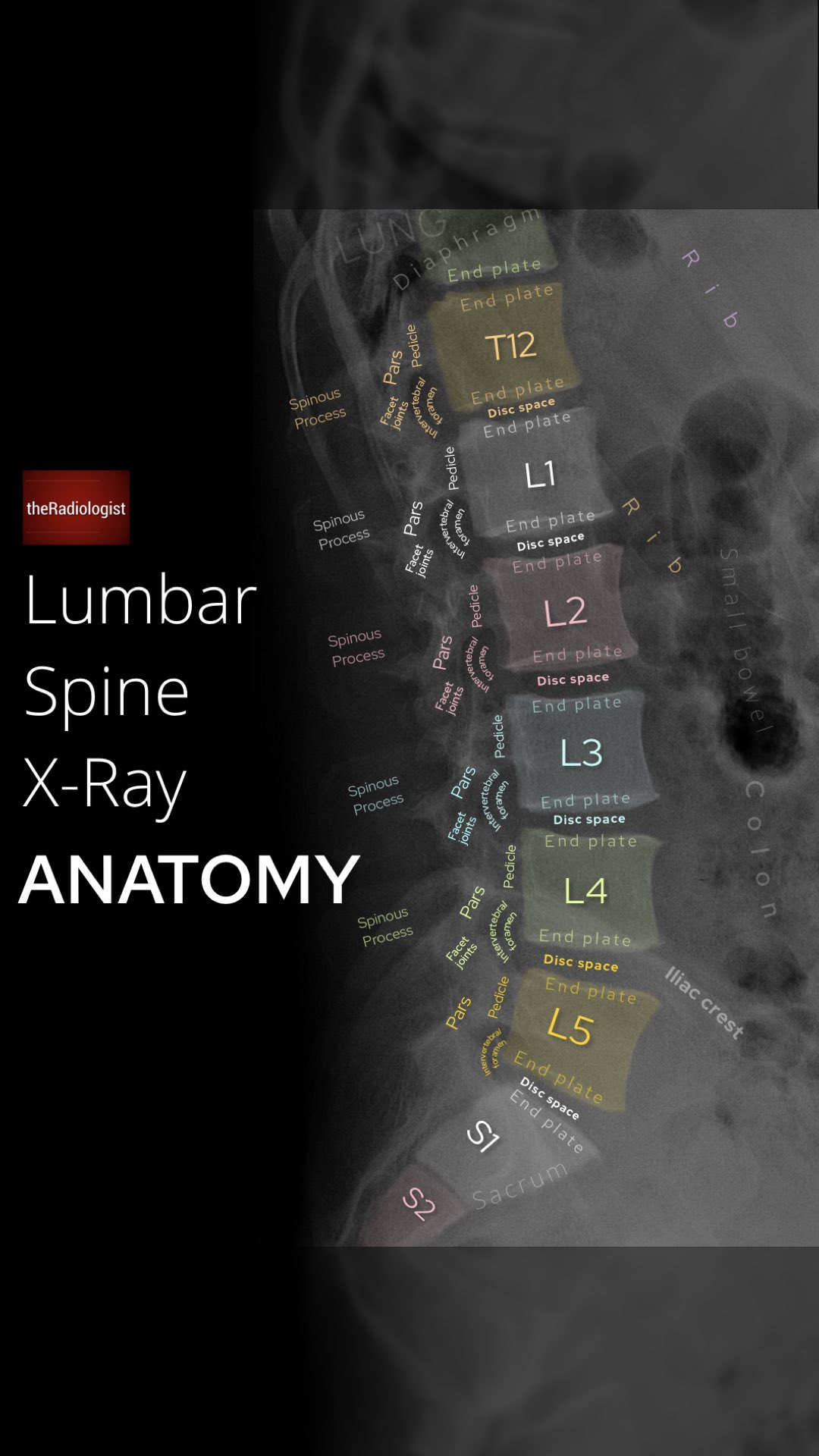 theRadiologist on Twitter: "Lateral lumbar spine X-ray anatomy https://t.co/BYZu8a7RAU" / Twitter