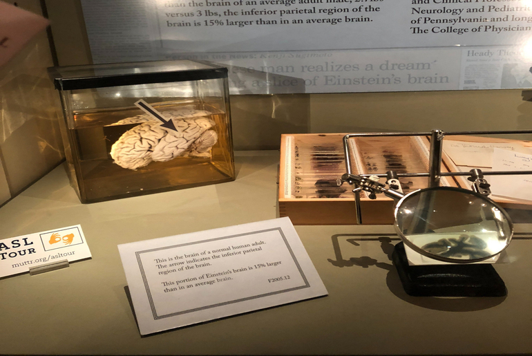 Einstein Brain In Museum