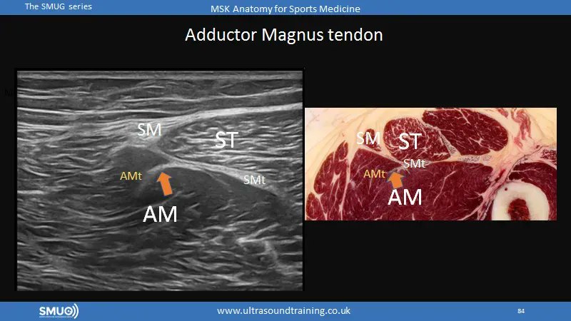 Adductor Muscles Ultrasound