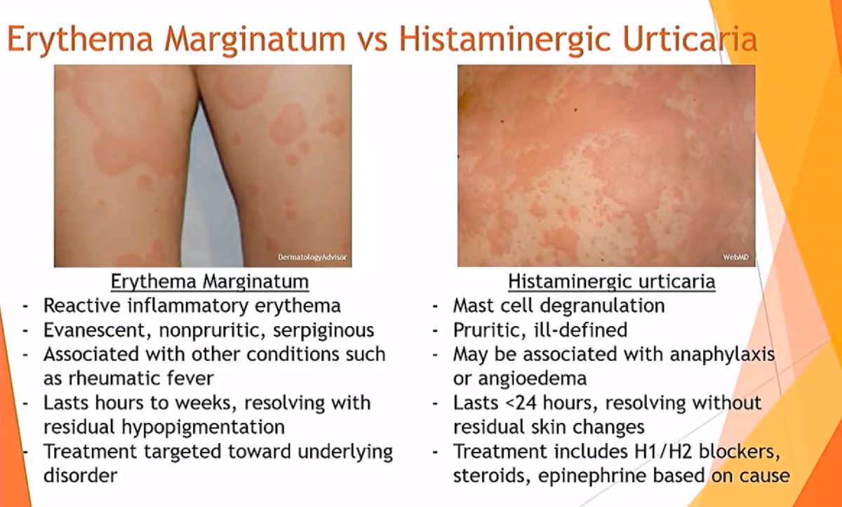 Online Dermatology Erythema Multiforme