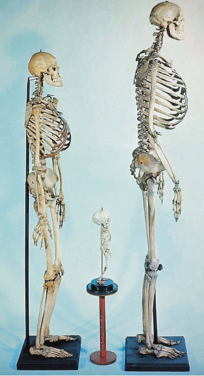 Tallest Human Skeleton Ever Found Harappa Grave Of Ancient 'couple'