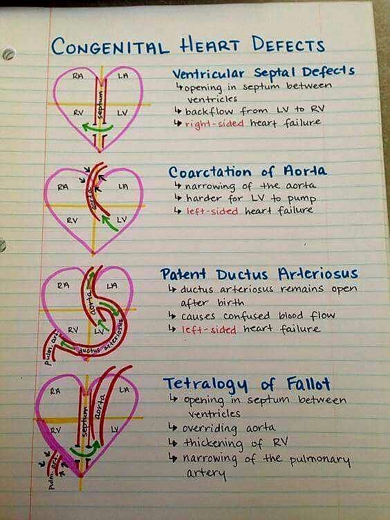 Congenital Heart Defects🫀 Different types in summary . - Thread from ...