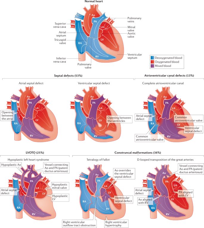 Congenital Heart Defects🫀 Different types in summary . - Thread from ...