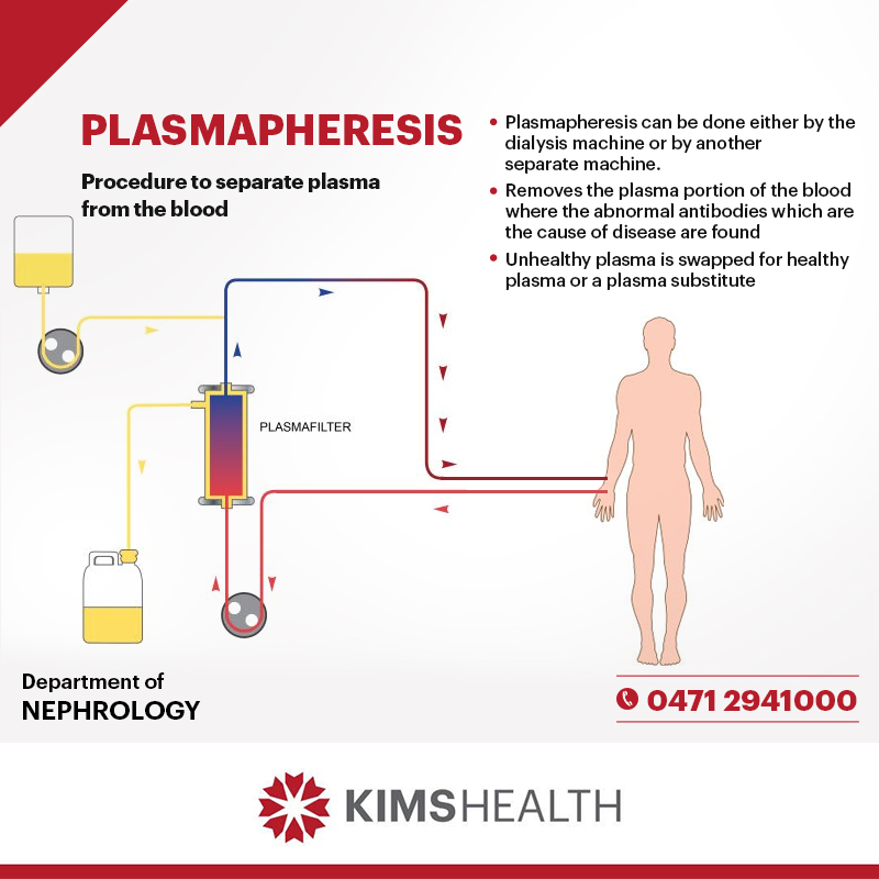 Plasmapheresis Process