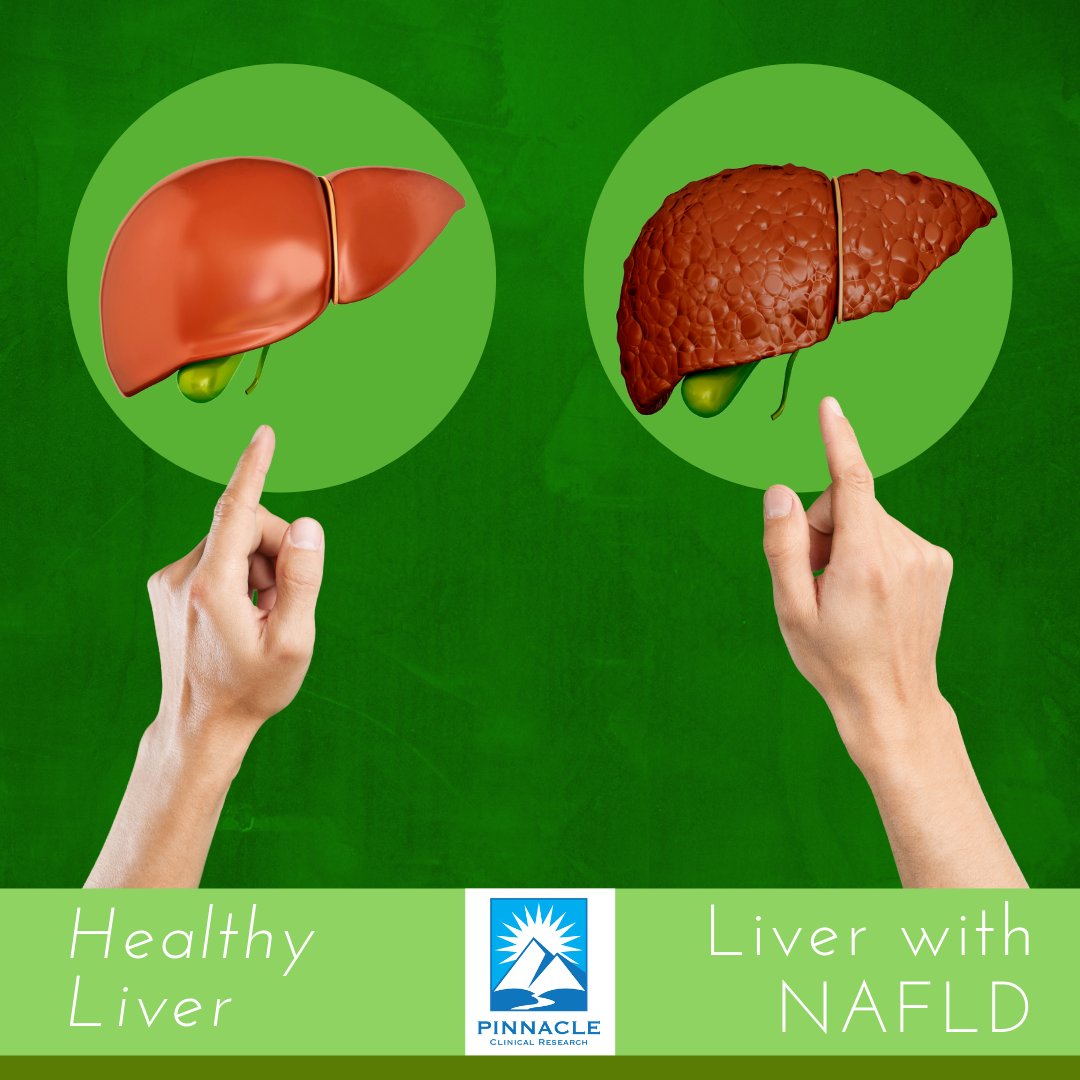 Unhealthy Liver