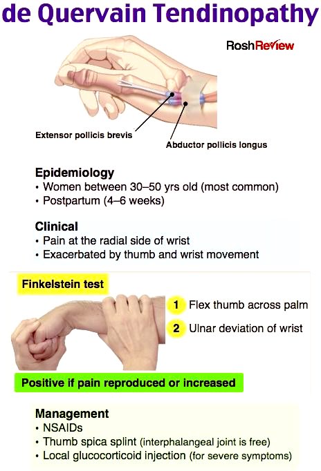 Extensor Pollicis Longus Test