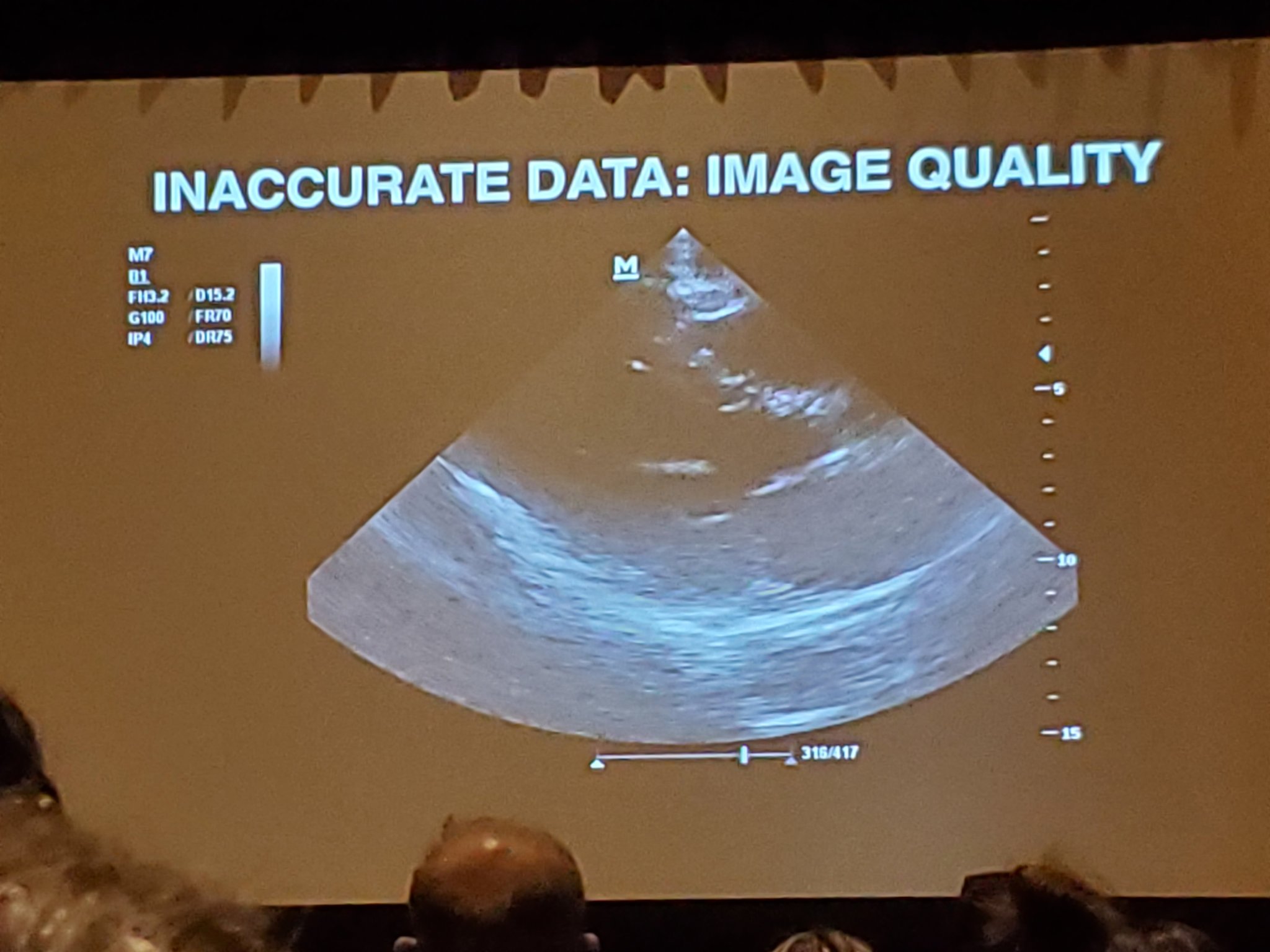 Kevin Piro (@Sono4Pyro) / Twitter