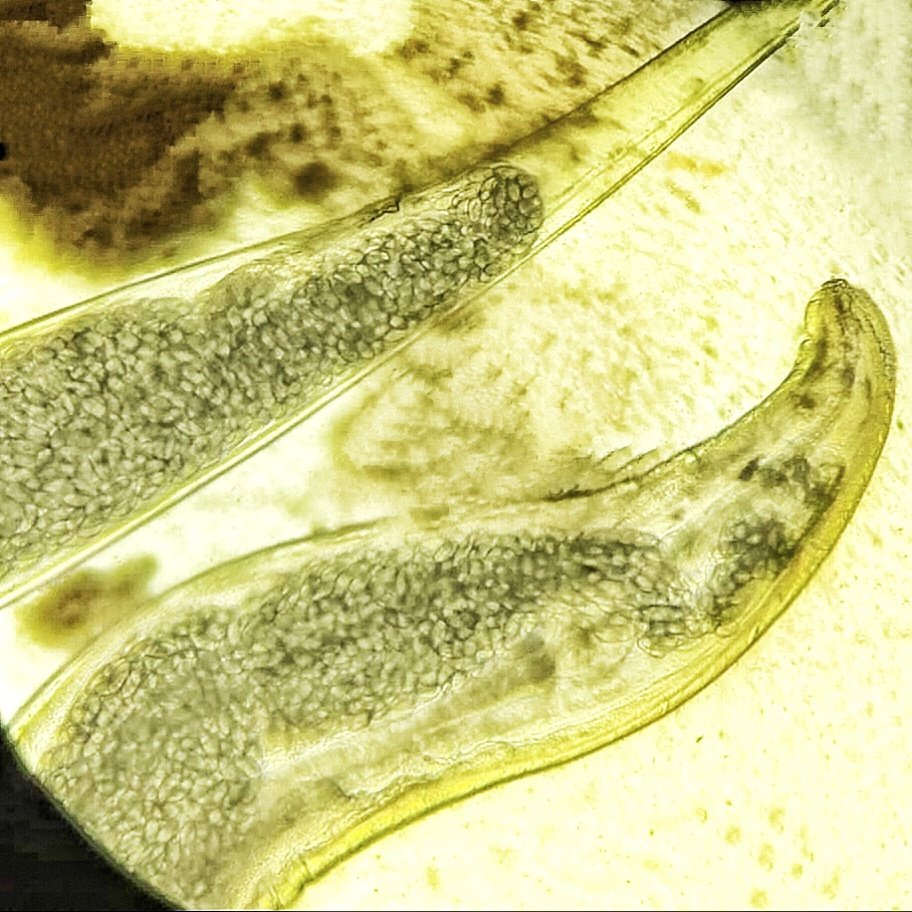 ☑️ Parts of 2 female Enterobius vermicularis worms containing numerous ...