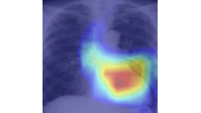Radiology: Artificial Intelligence on Twitter: "#DeepLearning model detects intrinsic features ...