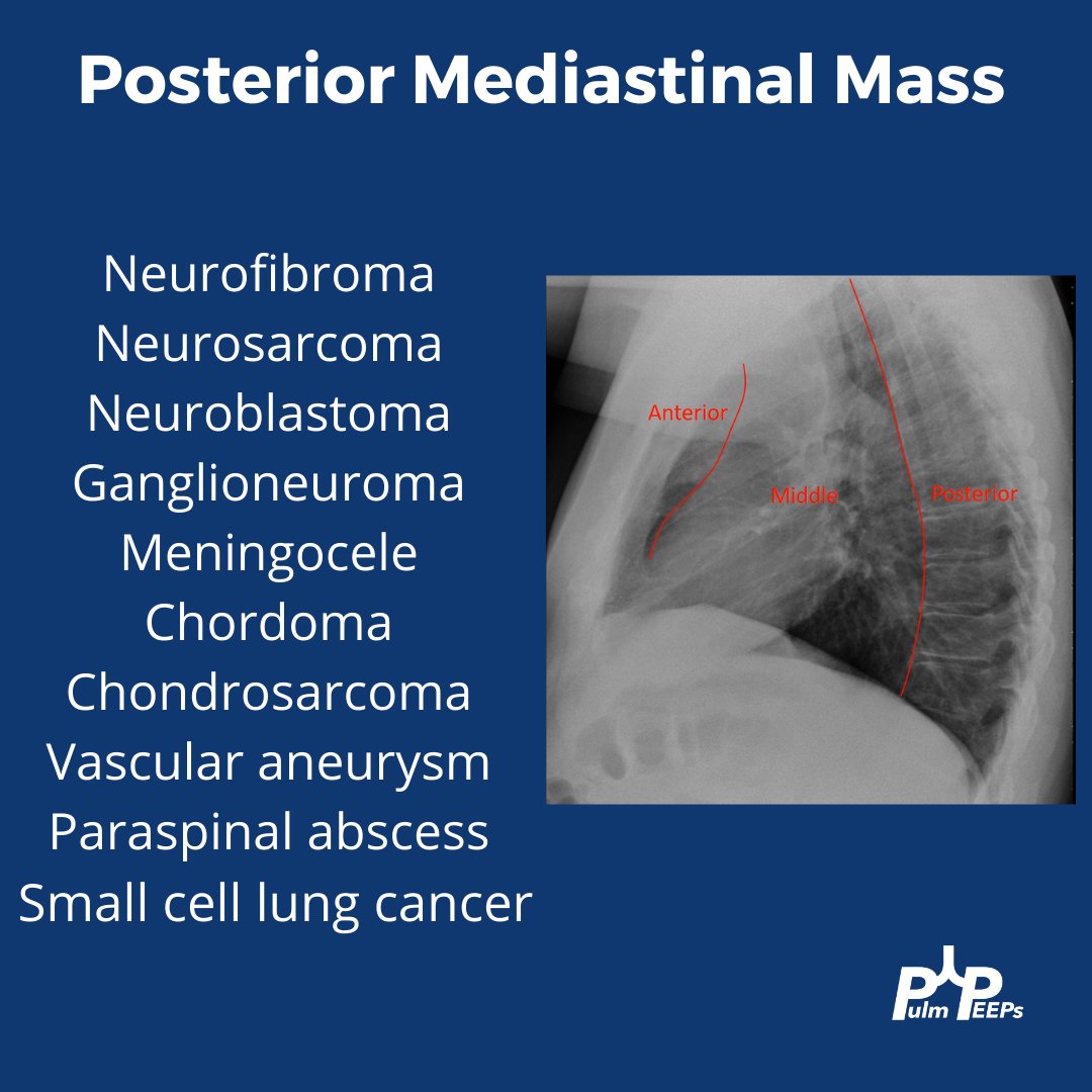 Posterior Mediastinum