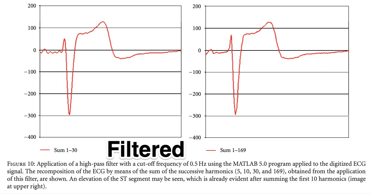 Nick Mark MD on Twitter: "The problem is we *NEED* some of those high & low frequency sine waves ...