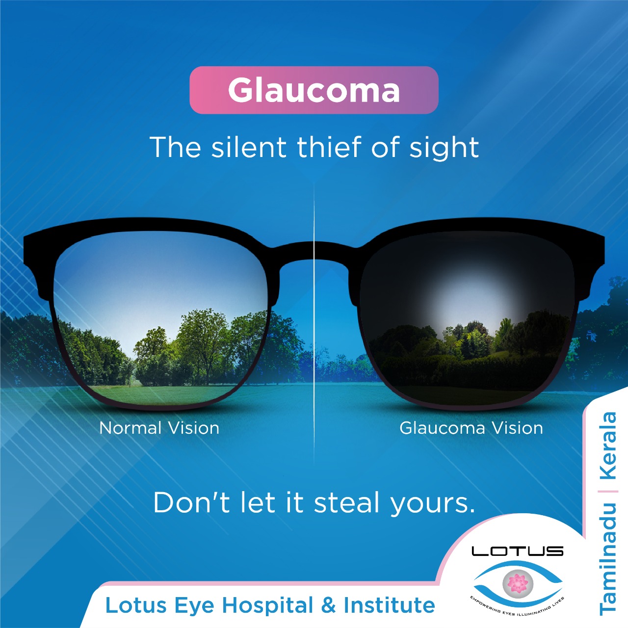 Glaucoma Vision