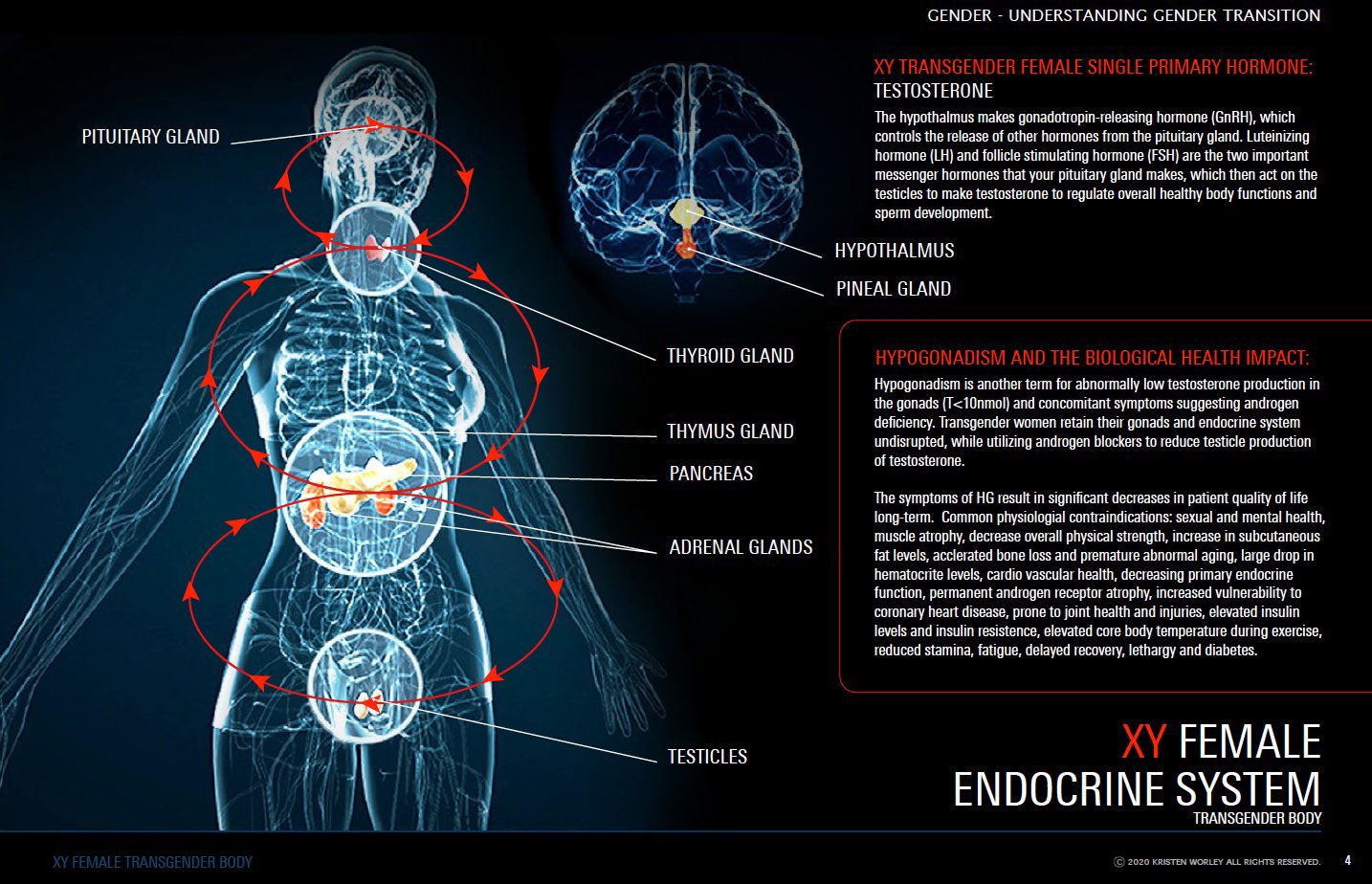 Transgender Anatomy Diagram