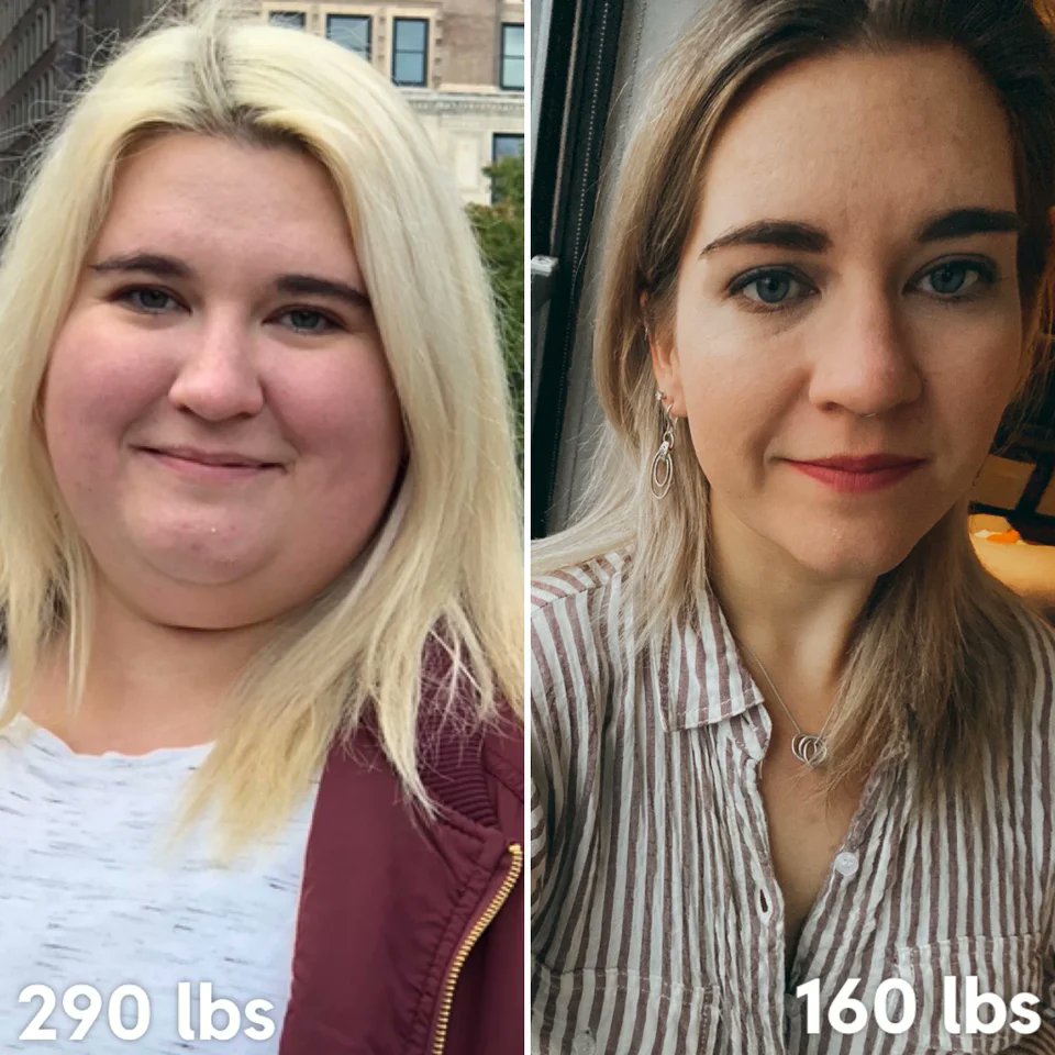 Prednisone Weight Gain