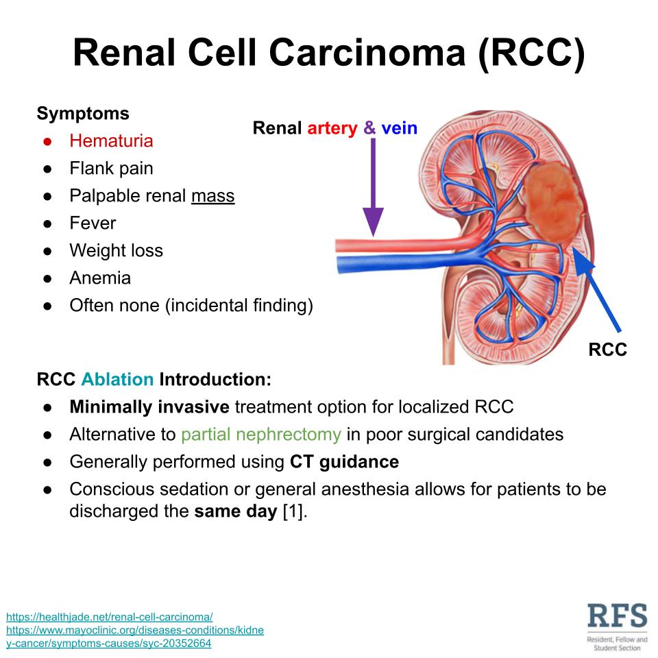 Renal Cell Carcinoma