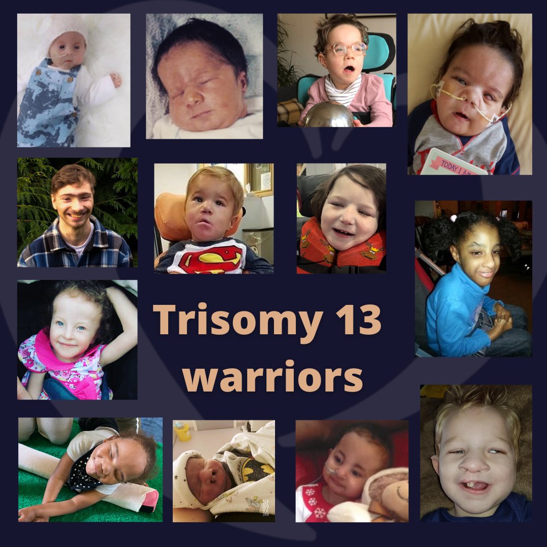 Trisomy 13 Baby